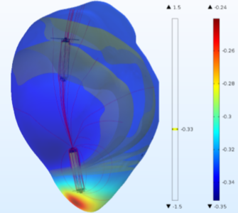 Optimizing Leadless Cardiac Pacemaker Communication